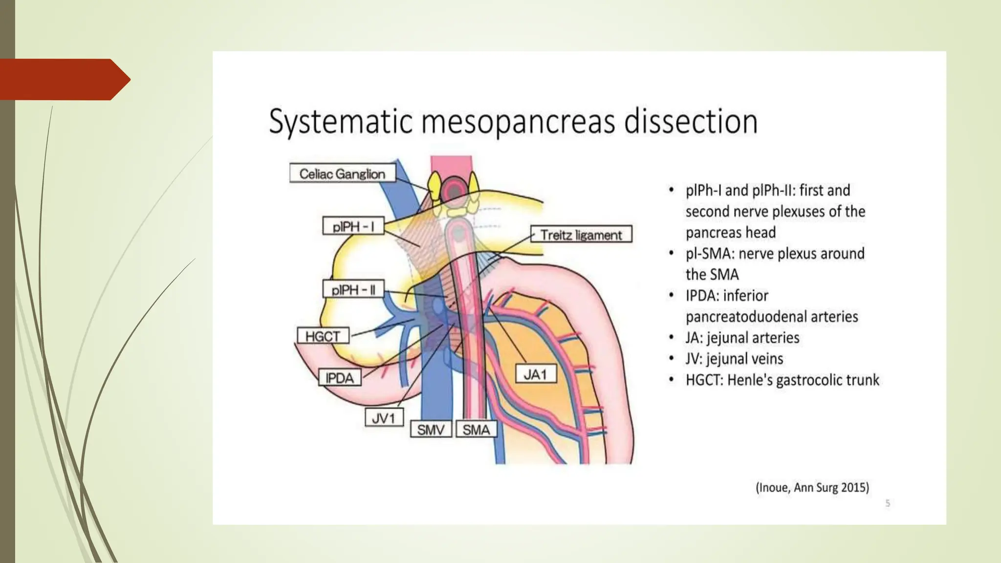 Management of MESOPANCREAS& TRIANGLE OPERATION.pptx