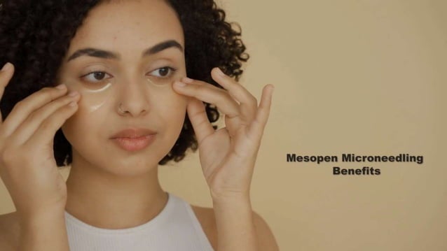 Microneedling Benefits | PPTX | Skin and Dermatology | Diseases and ...