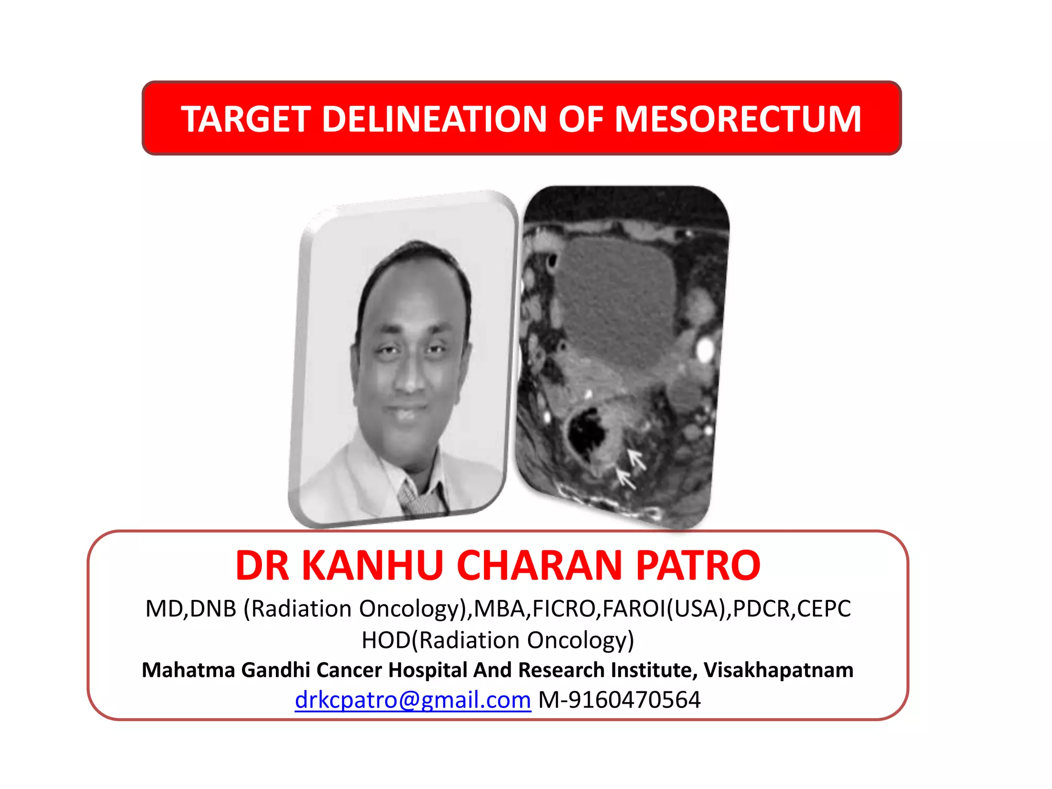 MESORECTUM TARGET DELINEATION | PPTX