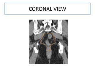 MESORECTUM TARGET DELINEATION | PPTX