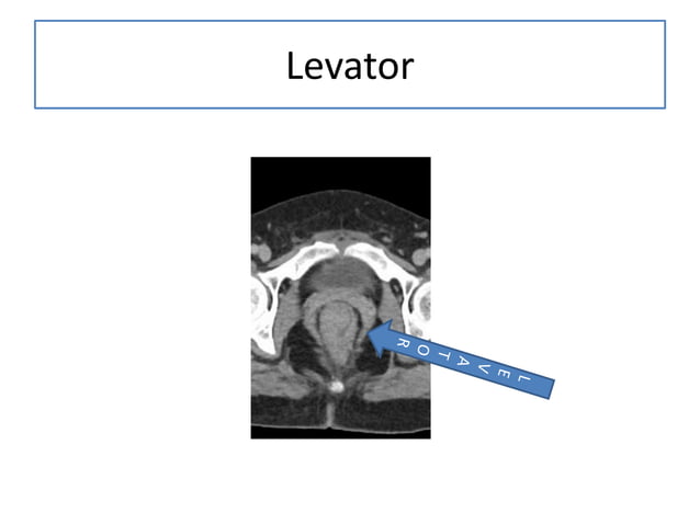 MESORECTUM TARGET DELINEATION | PPTX