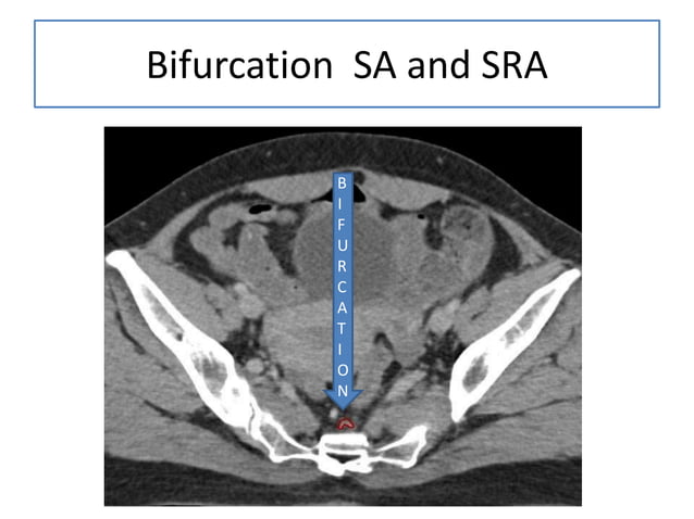 MESORECTUM TARGET DELINEATION | PPTX