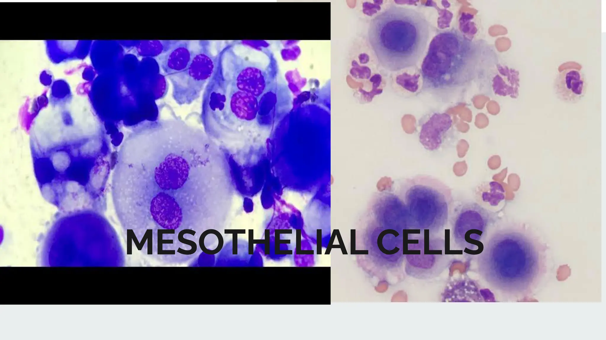 Mesothelial Cells - Cytology and Differential Diagnosis | PDF