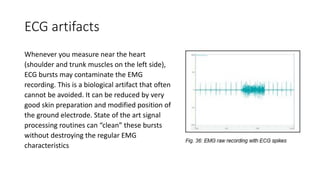 Mesurment of Electromyoghraphy(EMG) .pdf