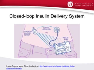 Risk of Hypoglycemia Associated with Different Insulin Delivery Systems ...