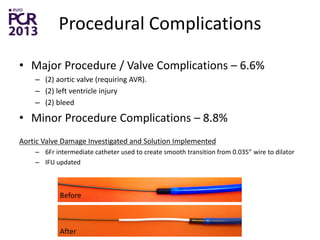 Meta analysis of percutaneous ventricular restoration (pvr) therapy ...