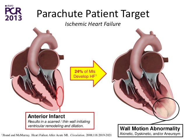 Meta analysis of percutaneous ventricular restoration (pvr) therapy u…