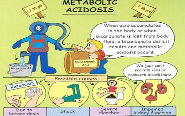 Metabolic acidosis by akram