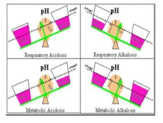 Metabolic acidosis | PPTX