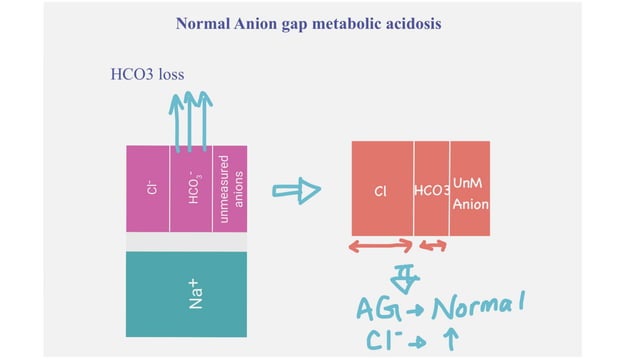 Metabolic Acidosis and the Anion Gap .pptx | Endocrine and Metabolic ...