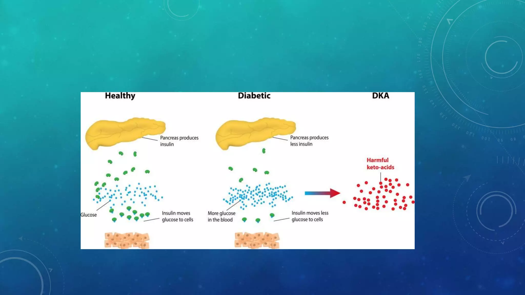 Metabolic acidosis ppt (types and pathophysiology) | PPTX