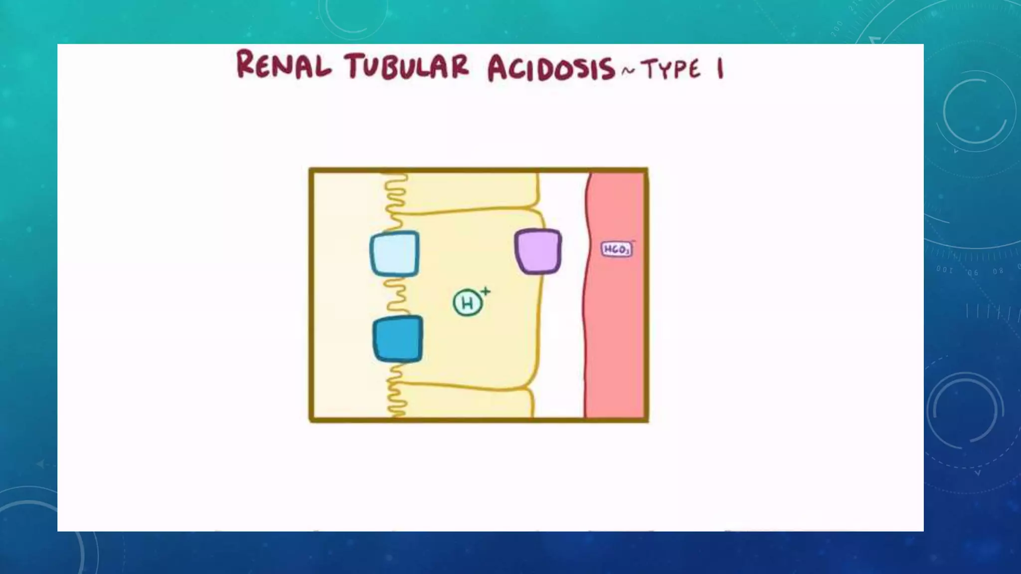 Metabolic acidosis ppt (types and pathophysiology) | PPTX