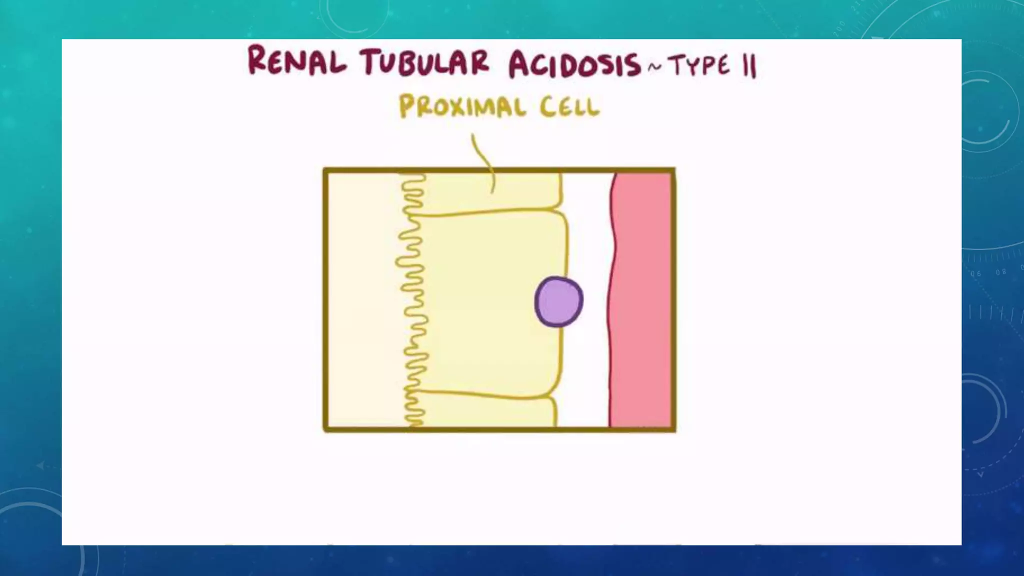 Metabolic acidosis ppt (types and pathophysiology) | PPTX
