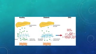 Metabolic acidosis ppt (types and pathophysiology) | PPTX