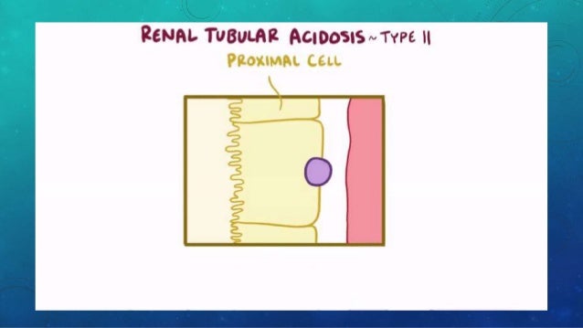 Metabolic acidosis ppt (types and pathophysiology)
