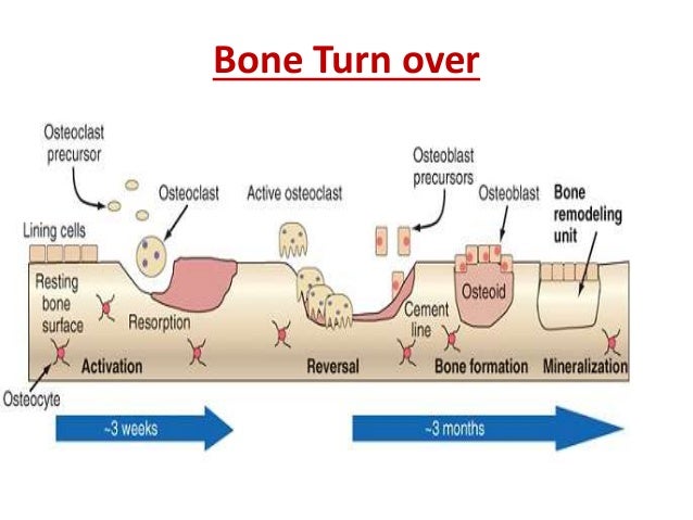 Metabolic bone disease