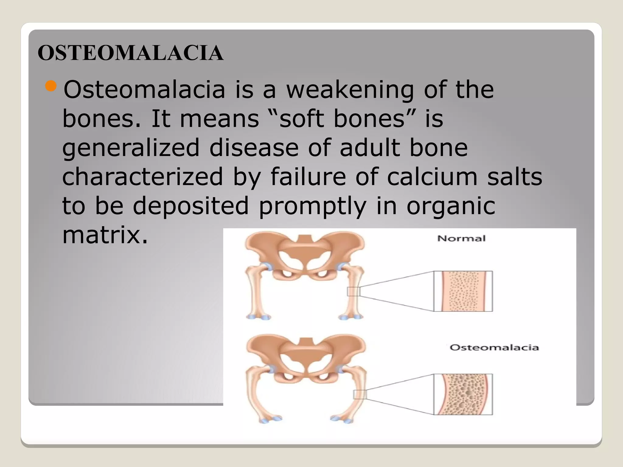 Metabolic bone disease | PDF