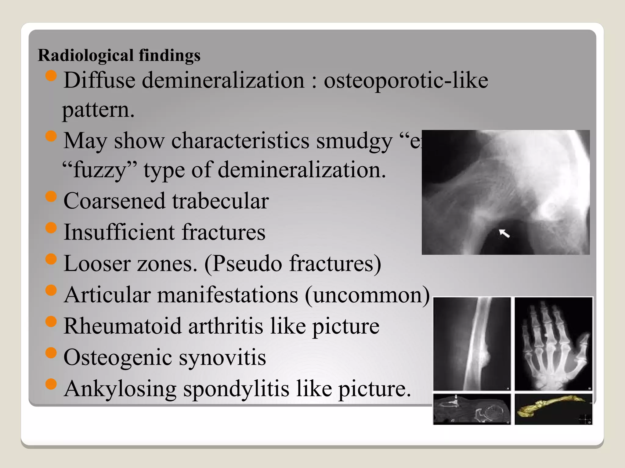 Metabolic bone disease | PDF