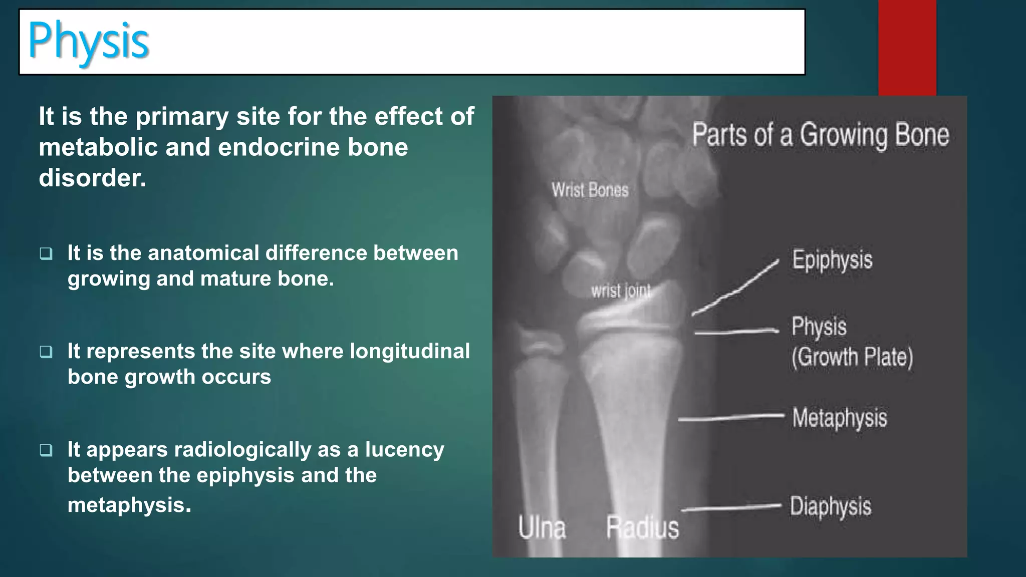 Metabolic & Endocrinal Diseases affecting bone | PPTX