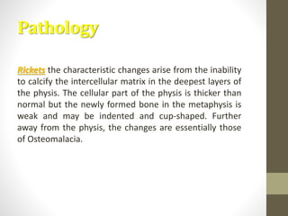 Metabolic bone disease.pptx | Bone and Joint Conditions | Diseases and Conditions