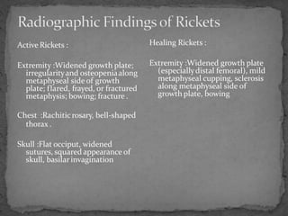metabolic bone disease.pptx