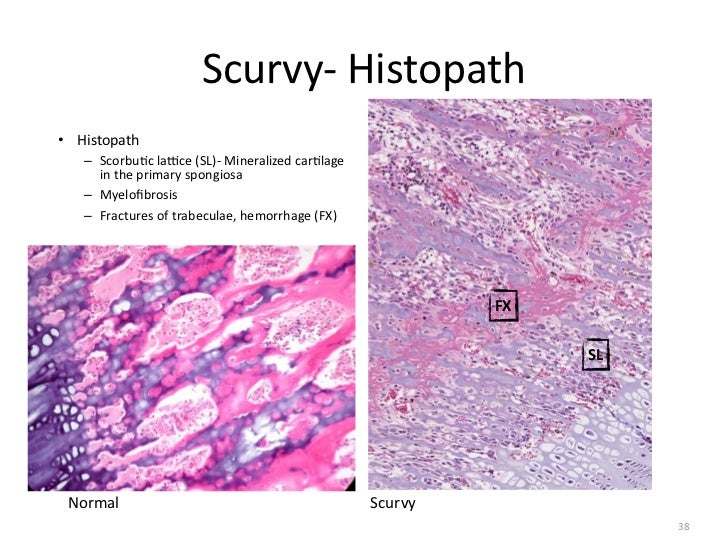 Metabolic bone disease 2011
