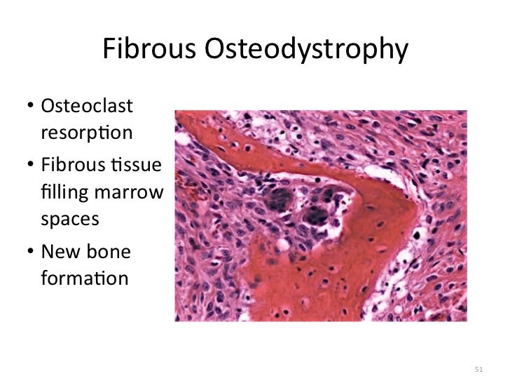 Metabolic bone disease 2011