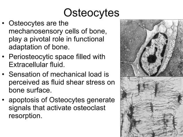 Metabolic Bone Disease Molecular Biology | PPT