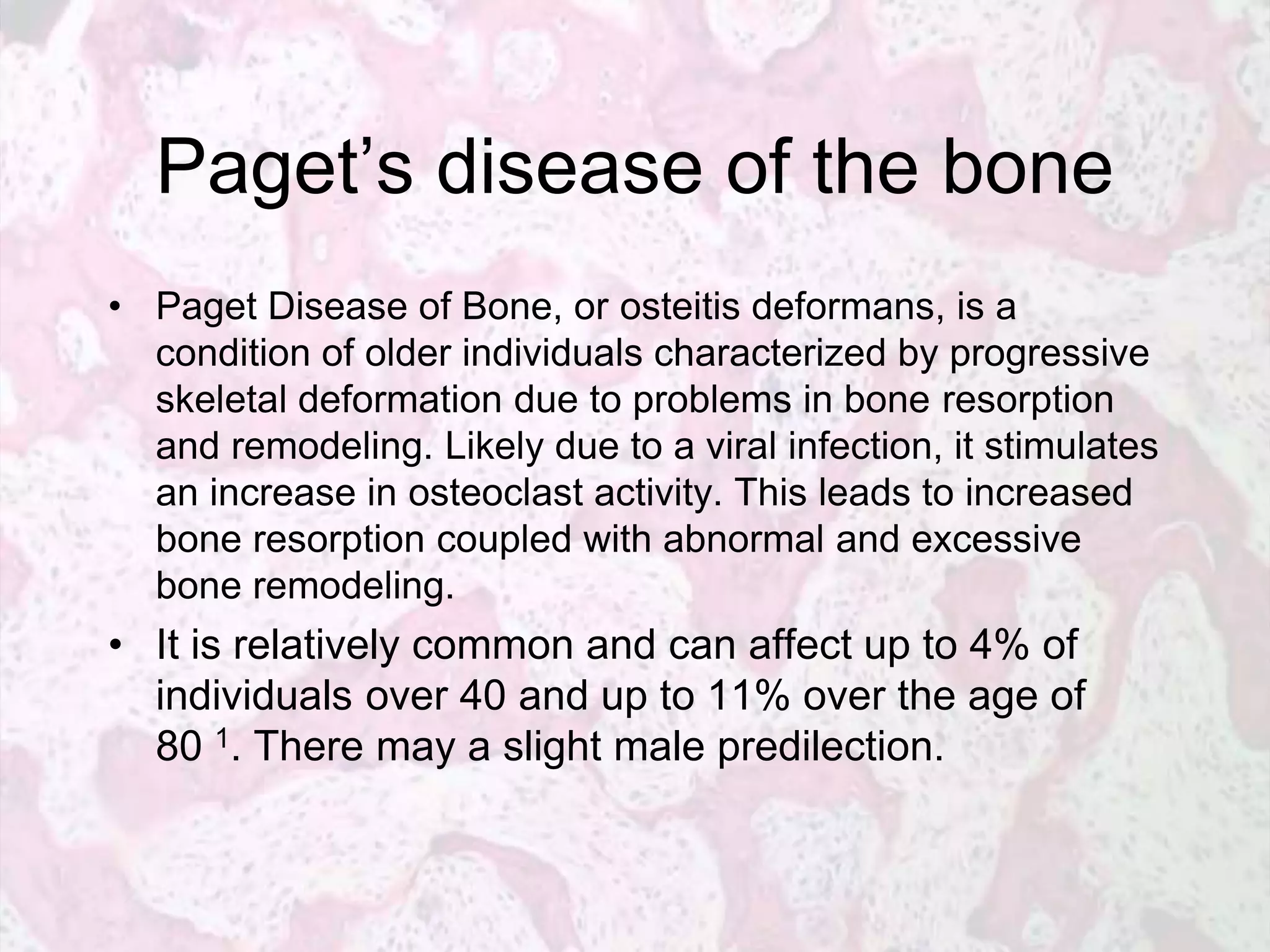 metabolic bone diseases | PPTX