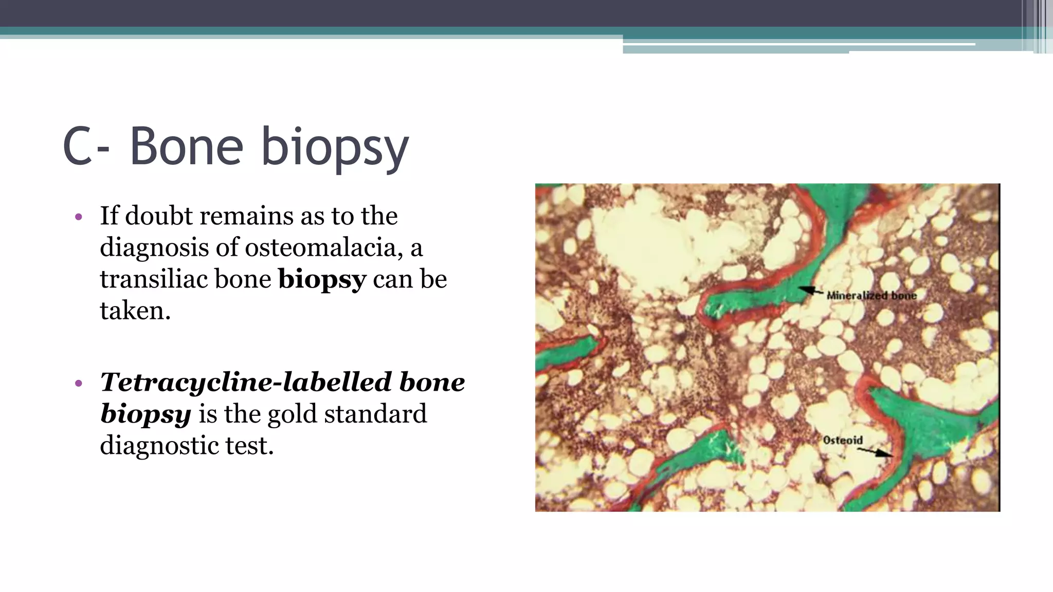 Metabolic bone diseases for students | PPTX