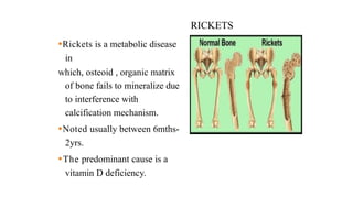 METABOLIC BONE DISEASES FINnAL.PPTX.pptx