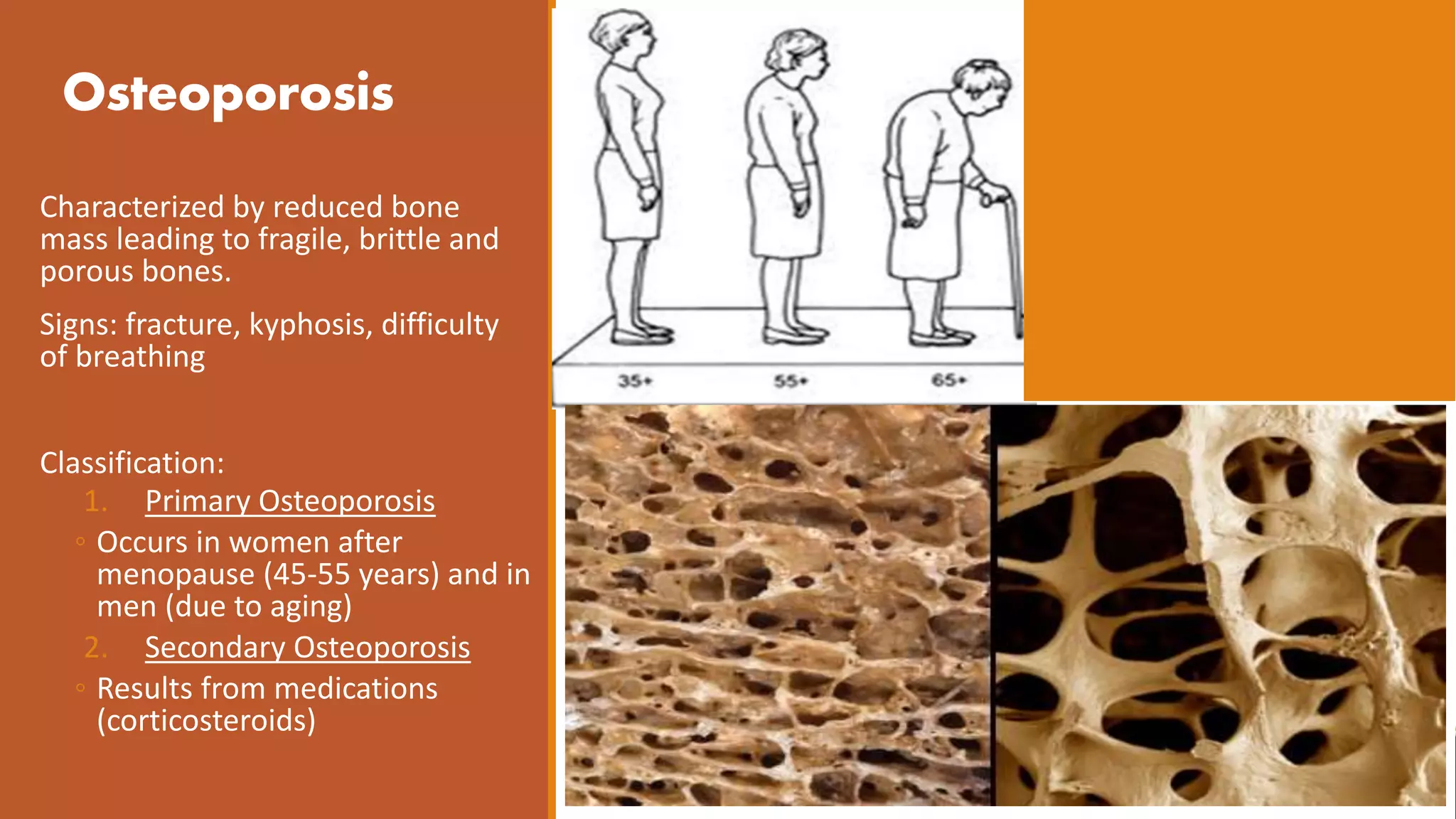 Metabolic bone disorders | PPTX