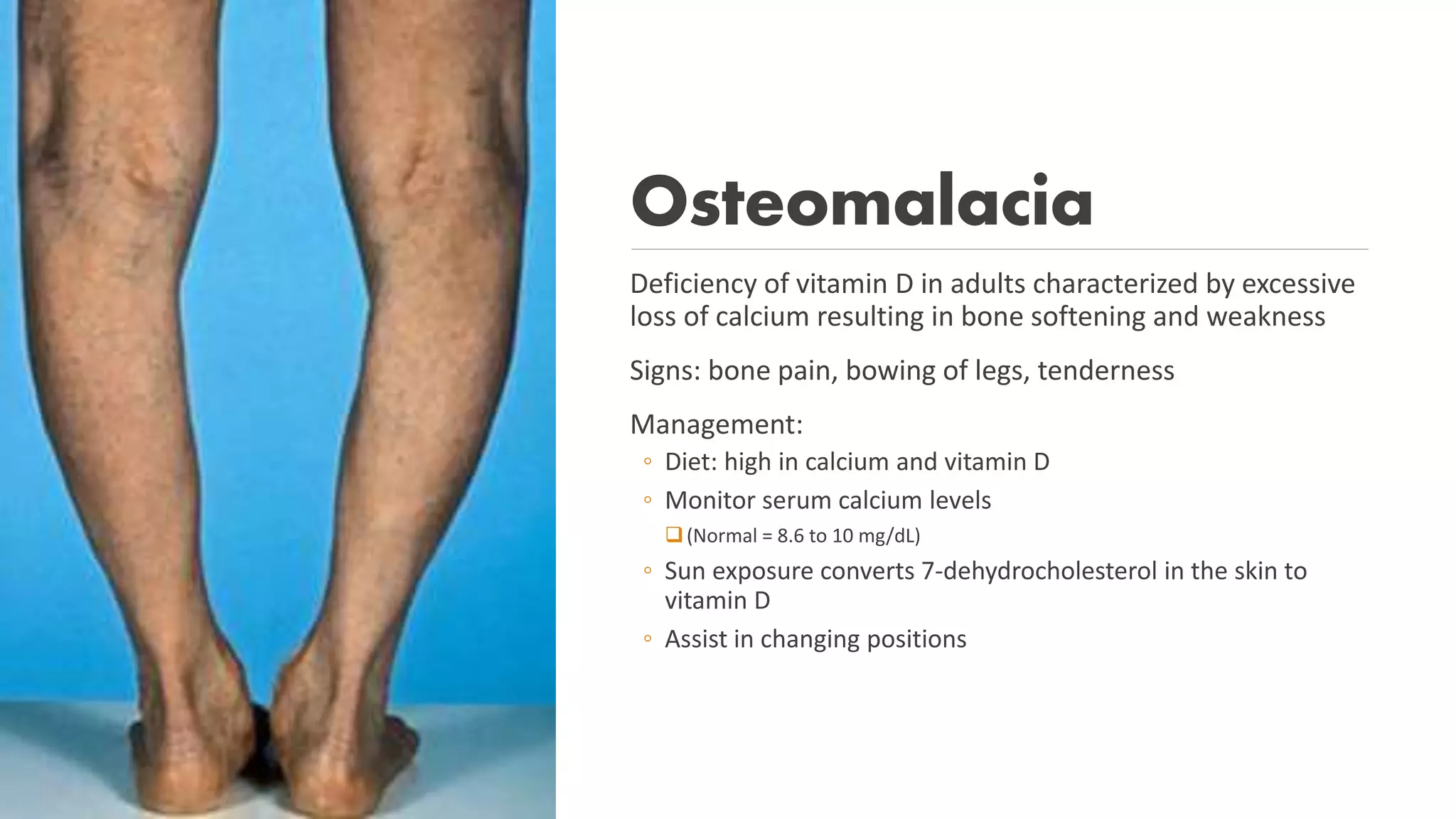 Metabolic bone disorders | PPTX