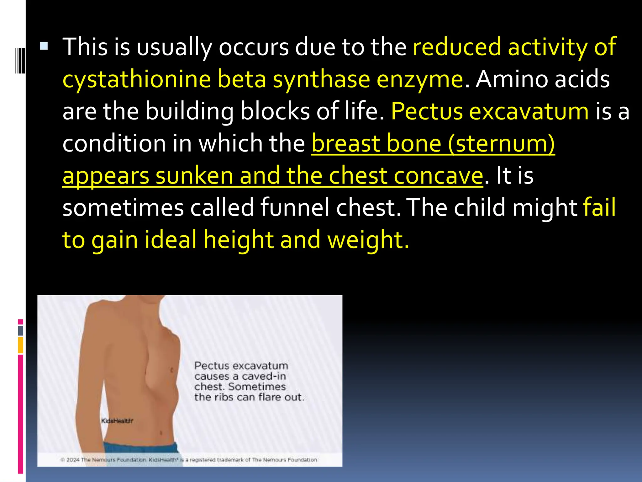 METABOLIC DISORDER IN CHILDREN in child healthnursing.pptx
