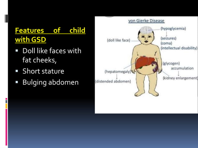 METABOLIC DISORDER IN CHILDREN in child healthnursing.pptx