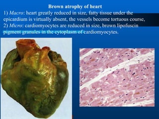 metabolic disorders blood disease pathology anatomy.ppt