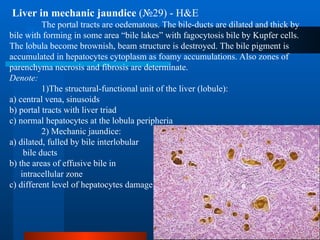 metabolic disorders. (1).ppt