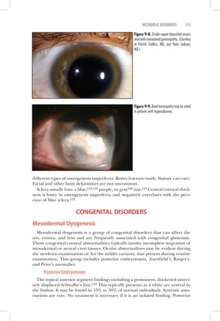 Metabolic disorders of the Eye : Michael Duplessie co-author | PDF