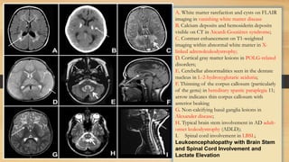 Metabolic disorders in neurology | PPTX