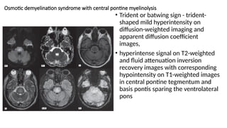 Imaging in Metabolic encephalopathy and dementia | PPTX