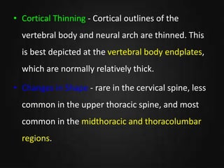 Metabolic & endocrine disorders of skeletal system | PPTX
