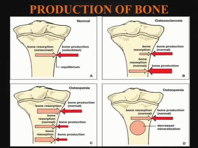 Metabolic And Endocrine Disorders Of Skeletal System Pptx 4250