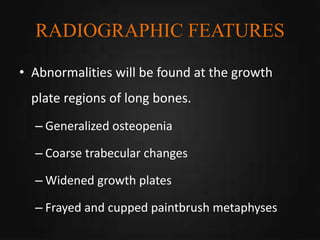 Metabolic & endocrine disorders of skeletal system | PPTX