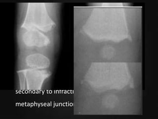 Metabolic & endocrine disorders of skeletal system | PPTX