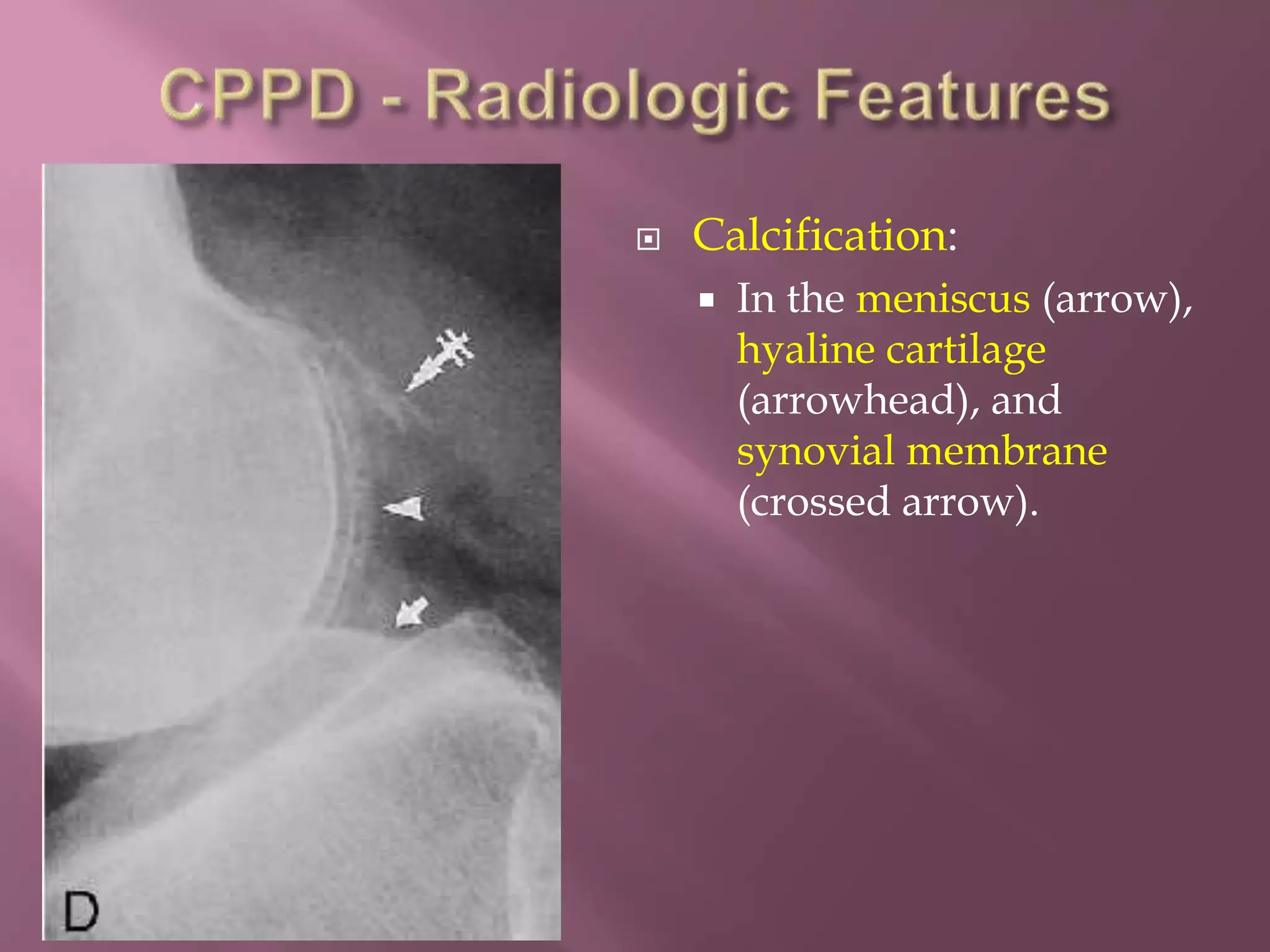 Metabolic (scurvy, gout, cppd, fluorosis) sayid | PPTX