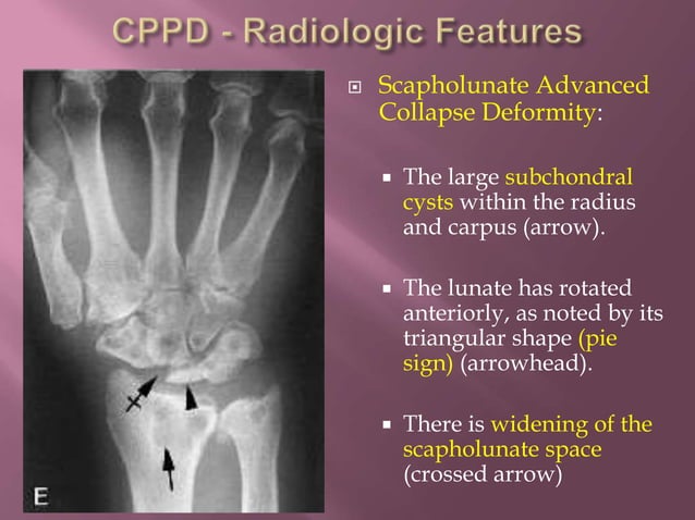 Metabolic (scurvy, gout, cppd, fluorosis) sayid | PPTX