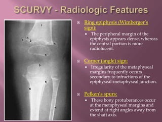 Metabolic (scurvy, gout, cppd, fluorosis) sayid | PPTX
