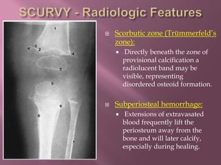 Metabolic (scurvy, gout, cppd, fluorosis) sayid | PPTX