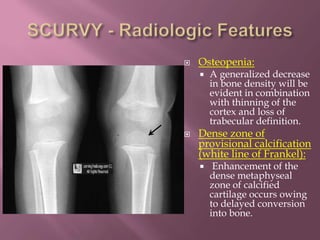 Metabolic (scurvy, gout, cppd, fluorosis) sayid | PPT