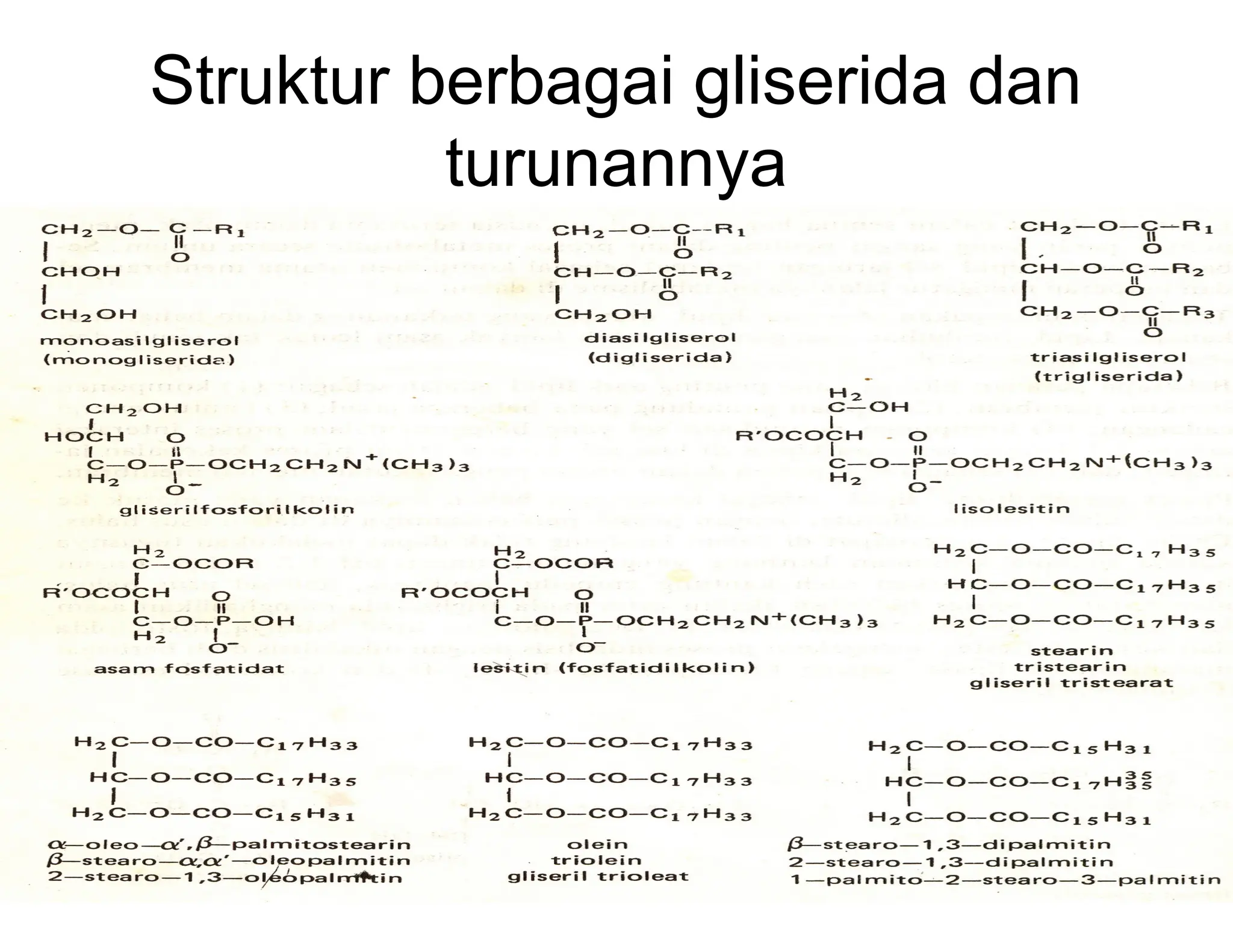 METABOLISME LIPID METABOLISME LIPIDMETABOLISME LIPID.ppt